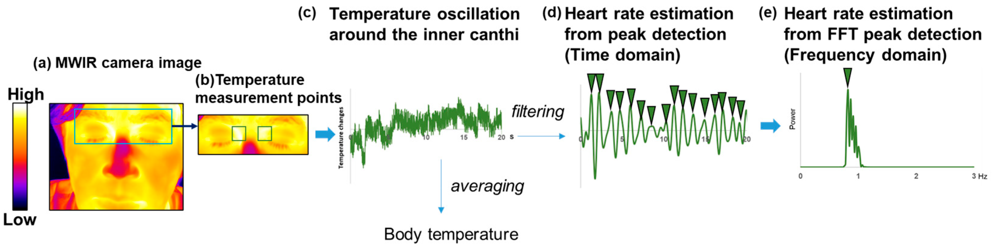 Noncontact Visualization of Respiration and Vital Sign Monitoring Using ...
