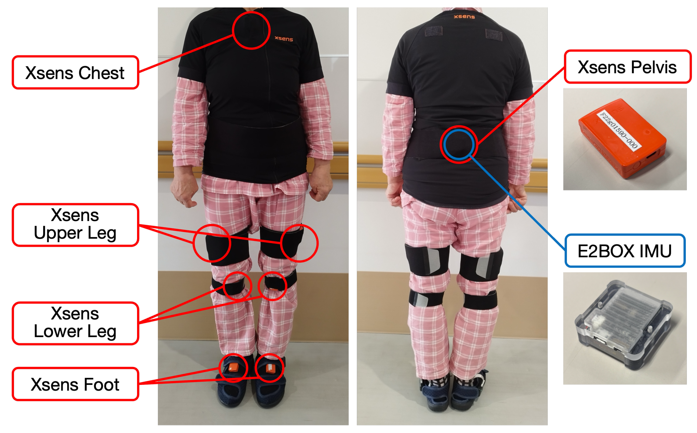 Individual Variability in Deep Learning-Based Joint Angle Estimation ...