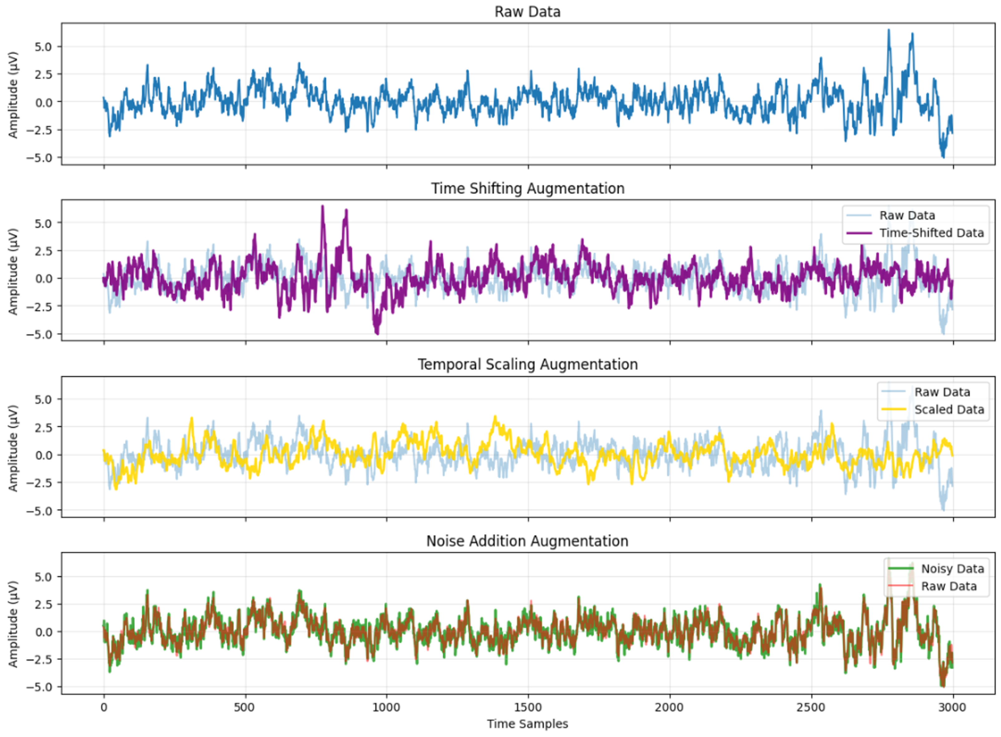 EEG Signal Classification with Data Augmentation for Epileptic Focus ...