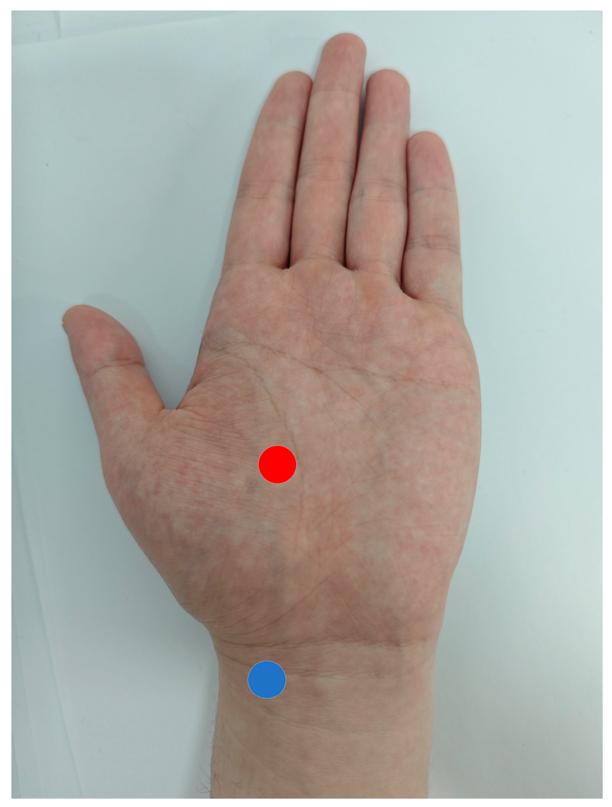 High-Fidelity rPPG Waveform Reconstruction from Palm Videos Using GANs