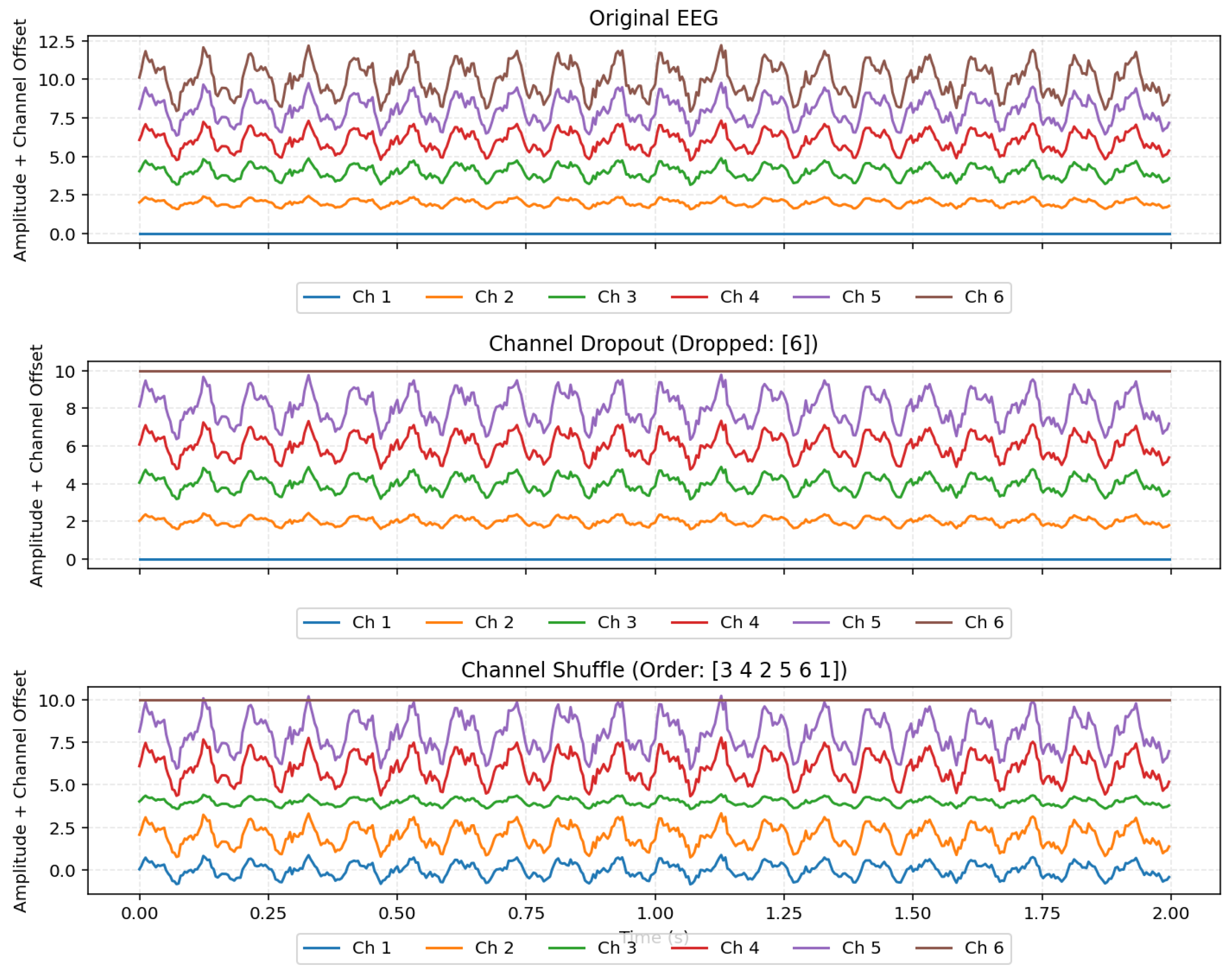 Influence of EEG Signal Augmentation Methods on Classification Accuracy ...