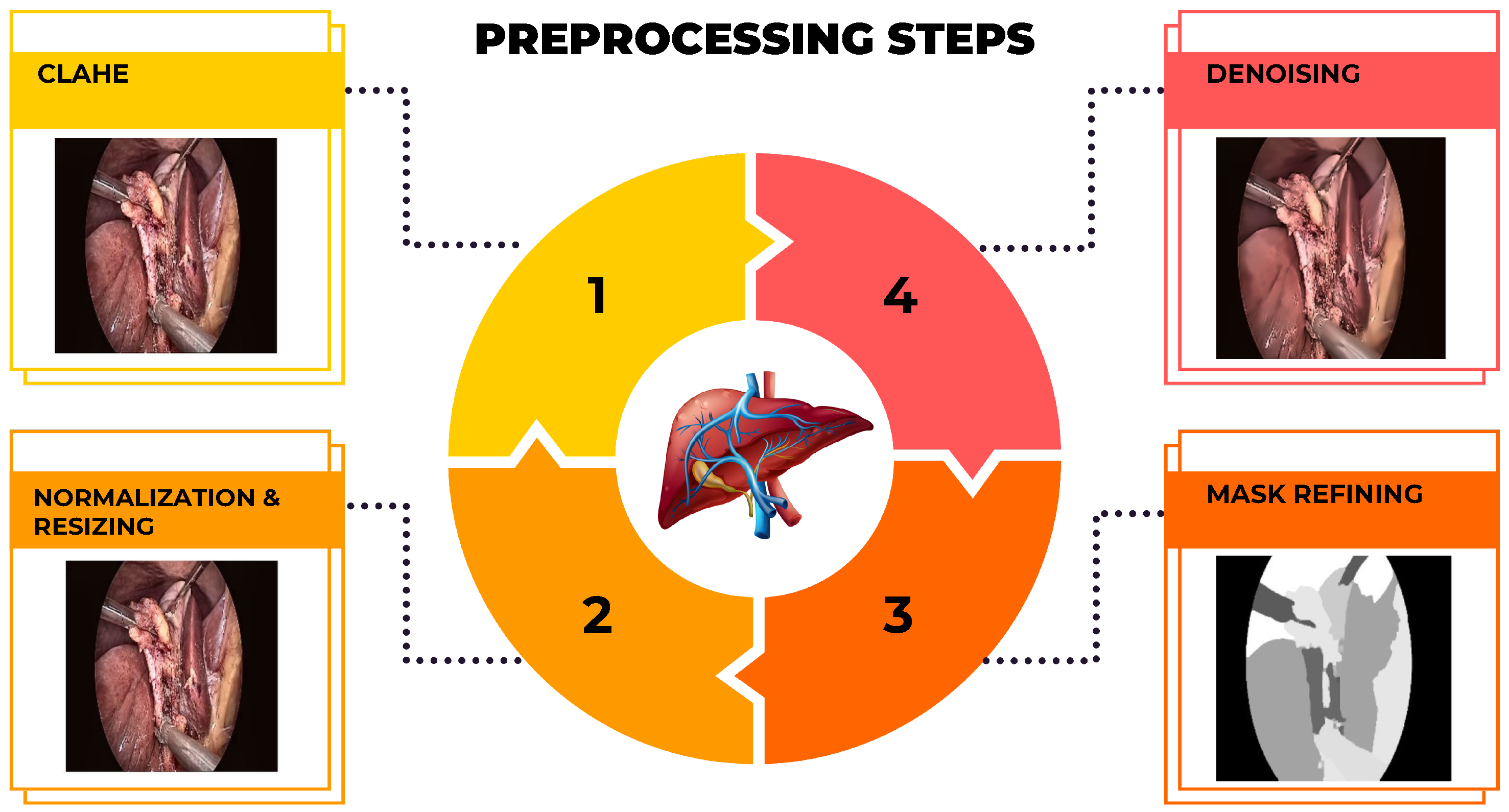 IMAU-Net: A Hybrid Multi-Scale Deep Learning Framework for Liver ...