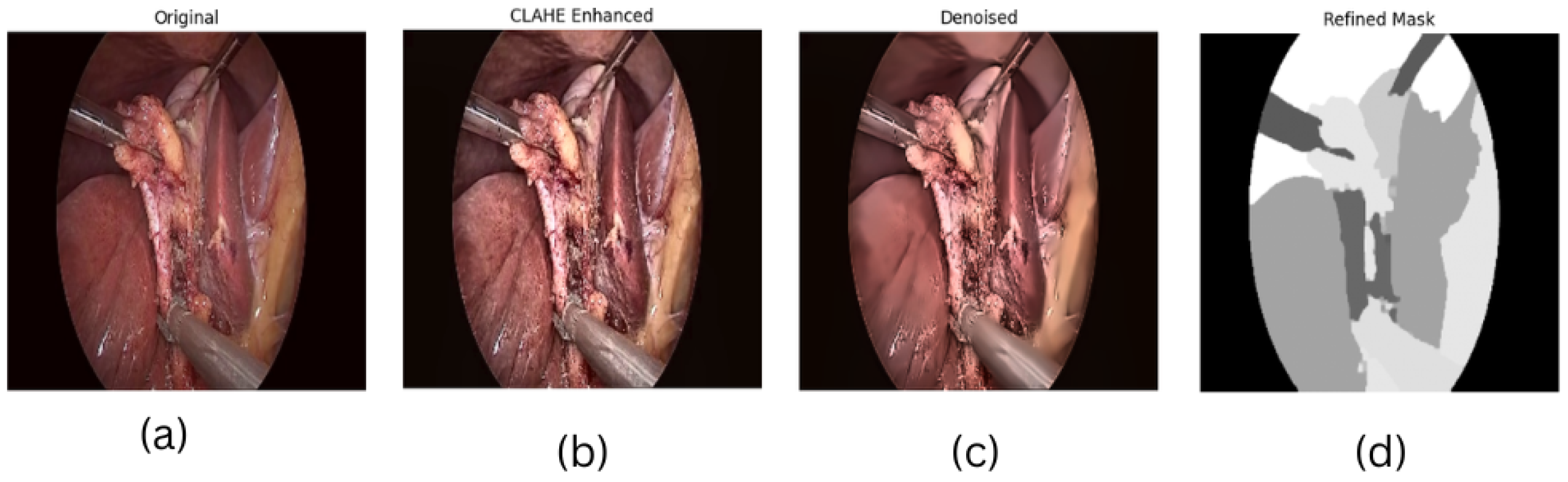 IMAU-Net: A Hybrid Multi-Scale Deep Learning Framework for Liver ...