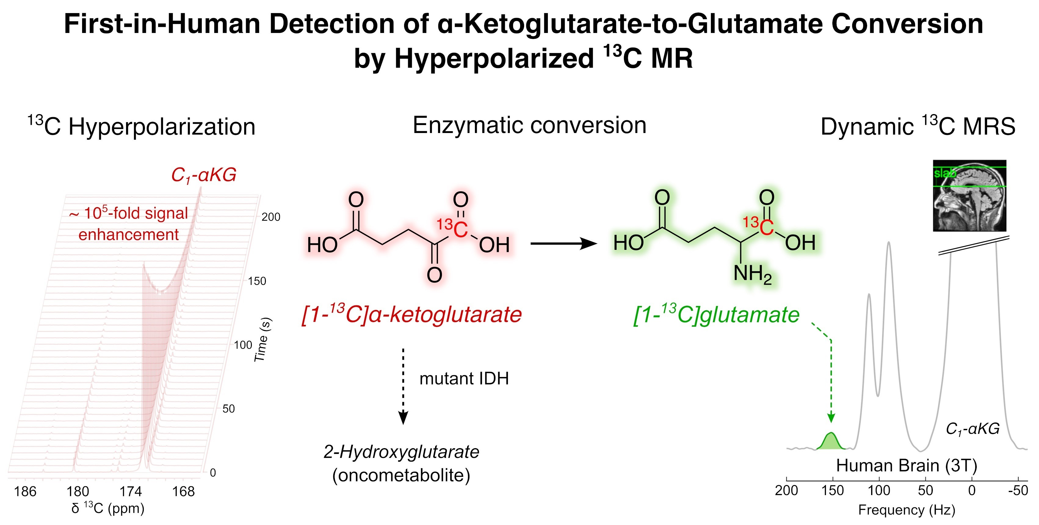Development and First-in-Human Translation of Hyperpolarized [1-13C ...