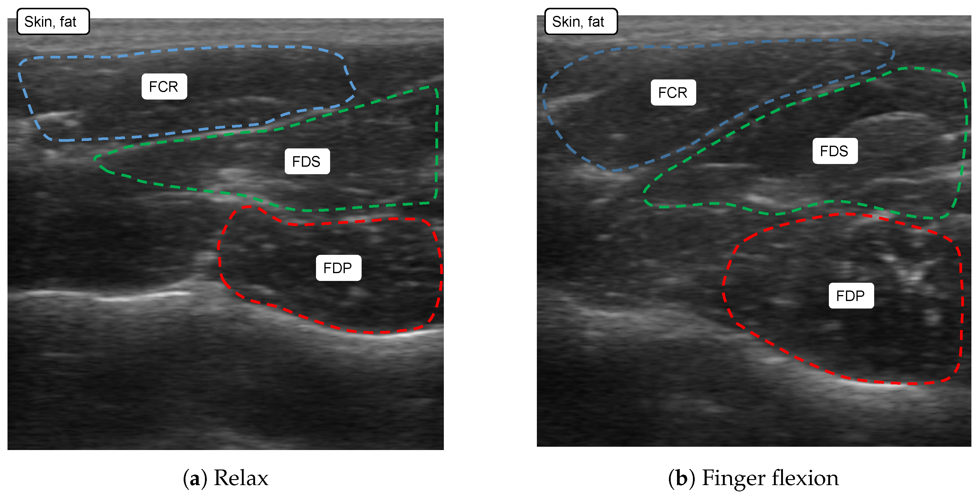 Depth-Sensitive Optical Sensing for Non-Invasive Measurement of Human ...