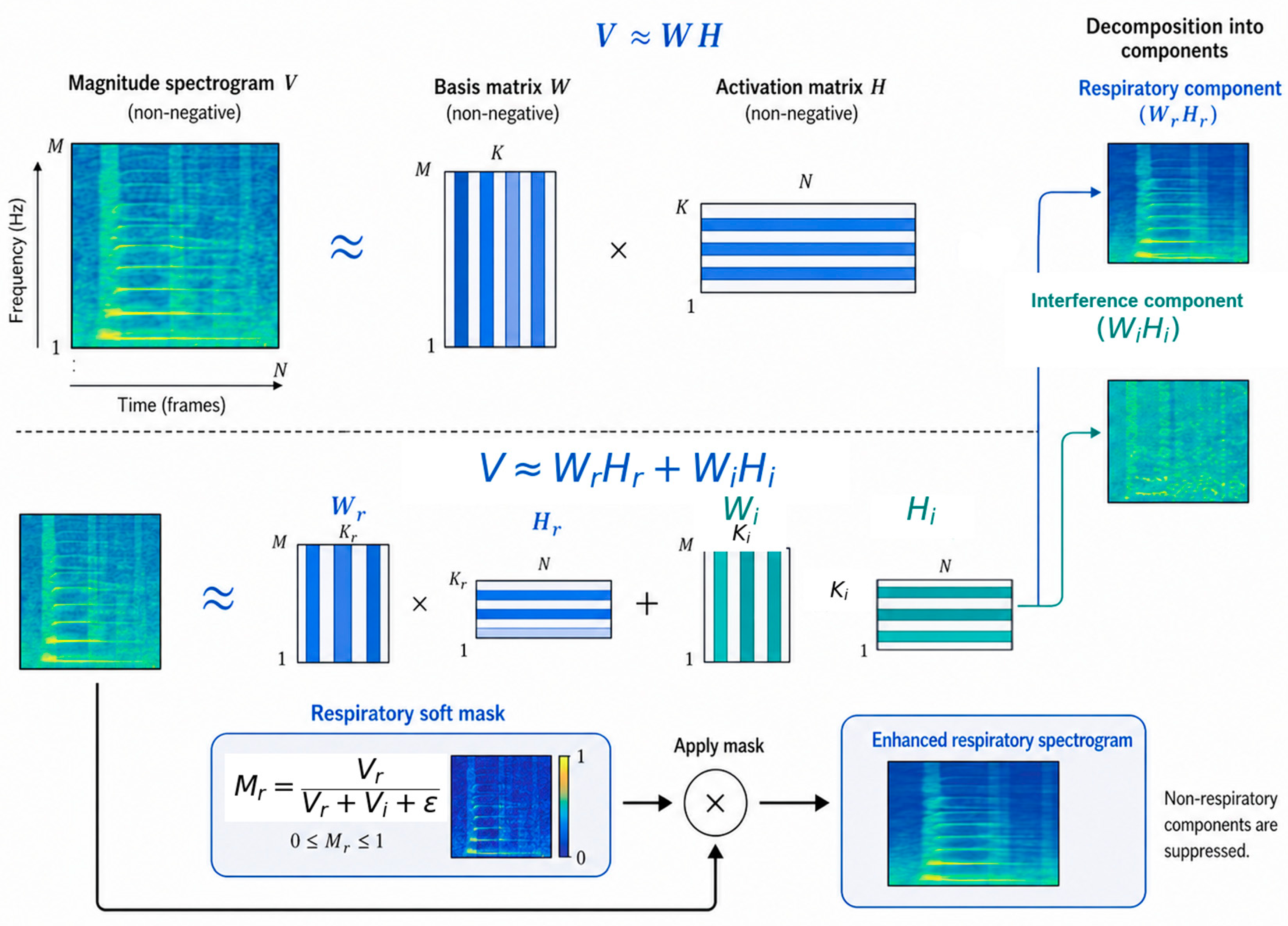 Respiratory Disease Classification Using NMF-Enhanced Log-Mel ...