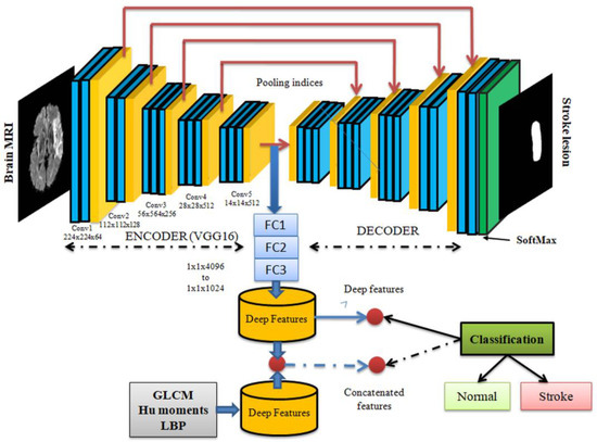 Deep Learning Framework to Detect Ischemic Stroke Lesion in Brain MRI ...