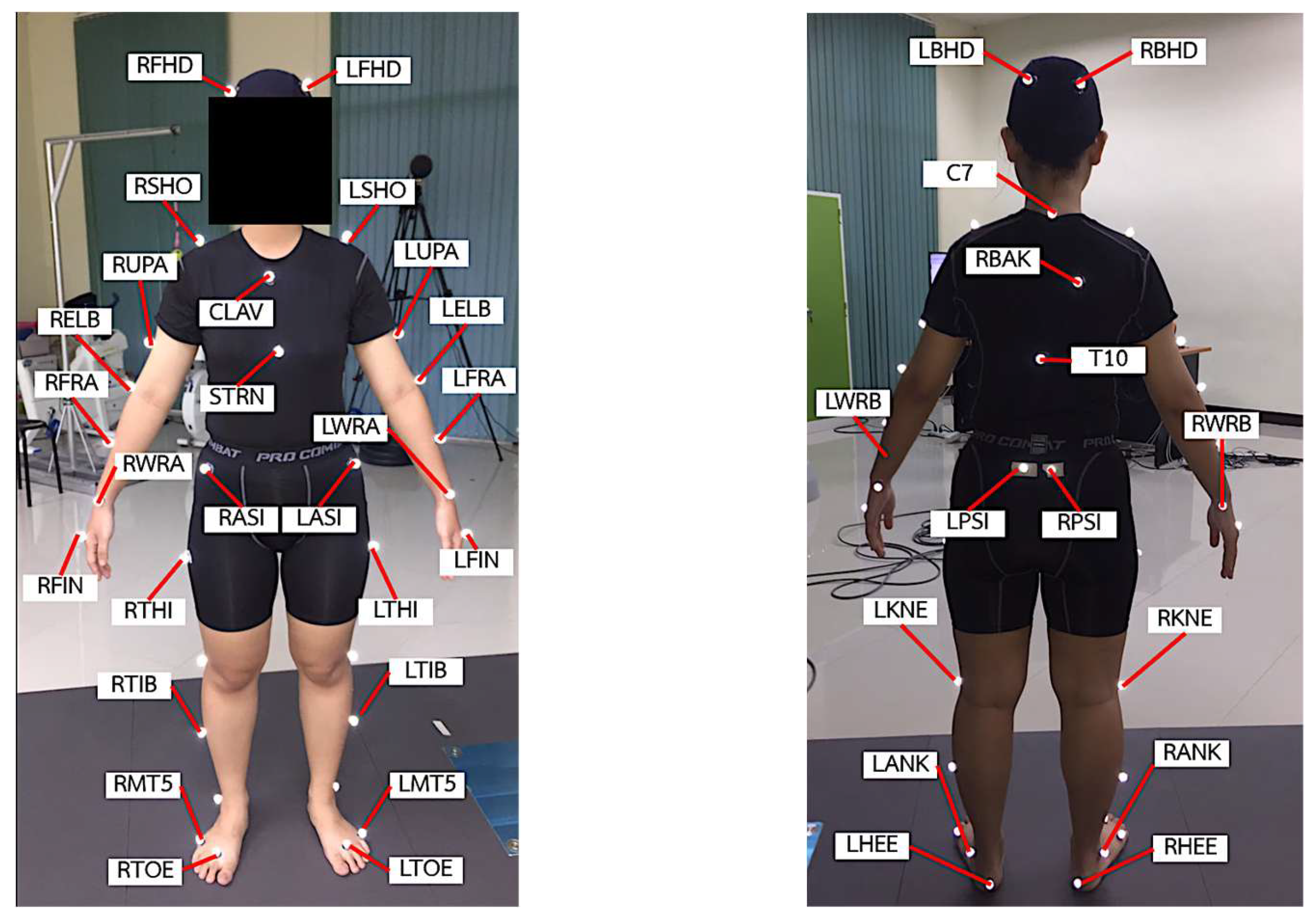 Inverse Dynamics Analysis of Knee Joint Kinetics During Squatting: A ...