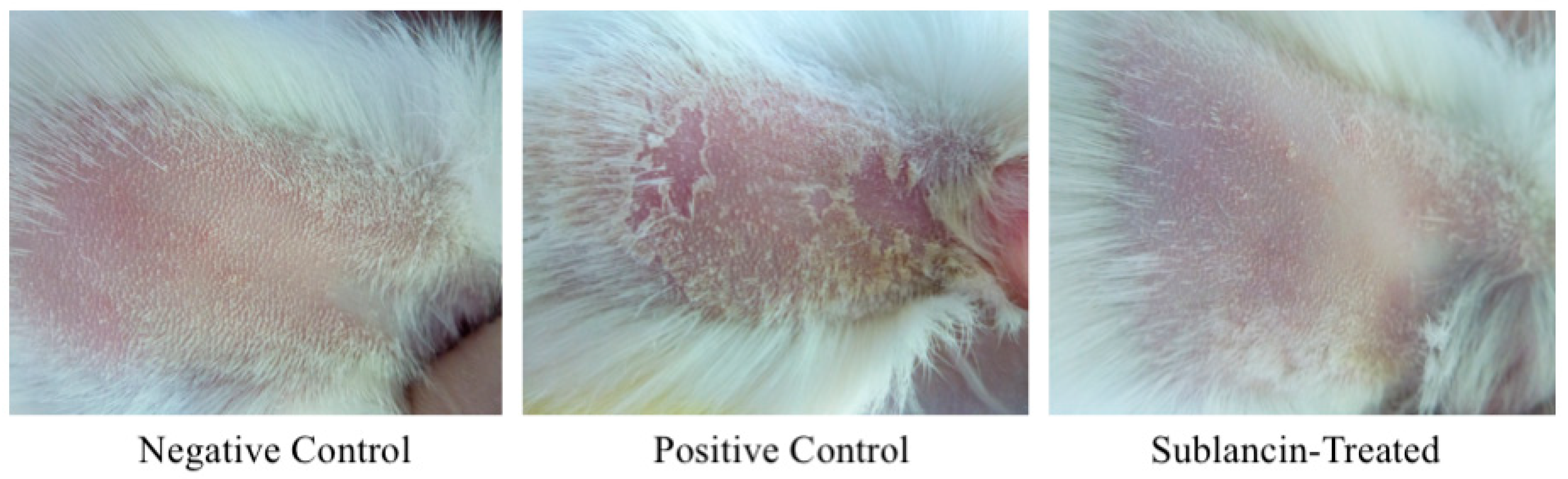 Antimicrobial Peptide Sublancin Skin Sensitization and Irritation ...