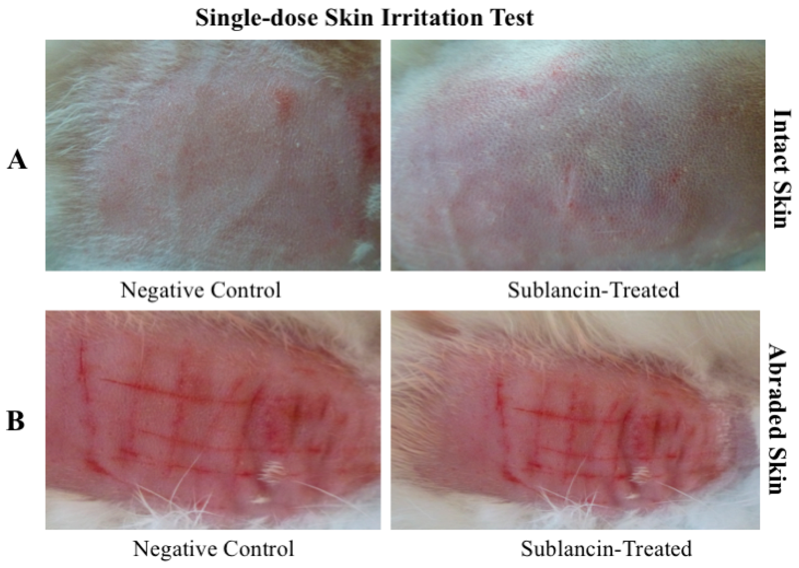 Antimicrobial Peptide Sublancin Skin Sensitization and Irritation ...