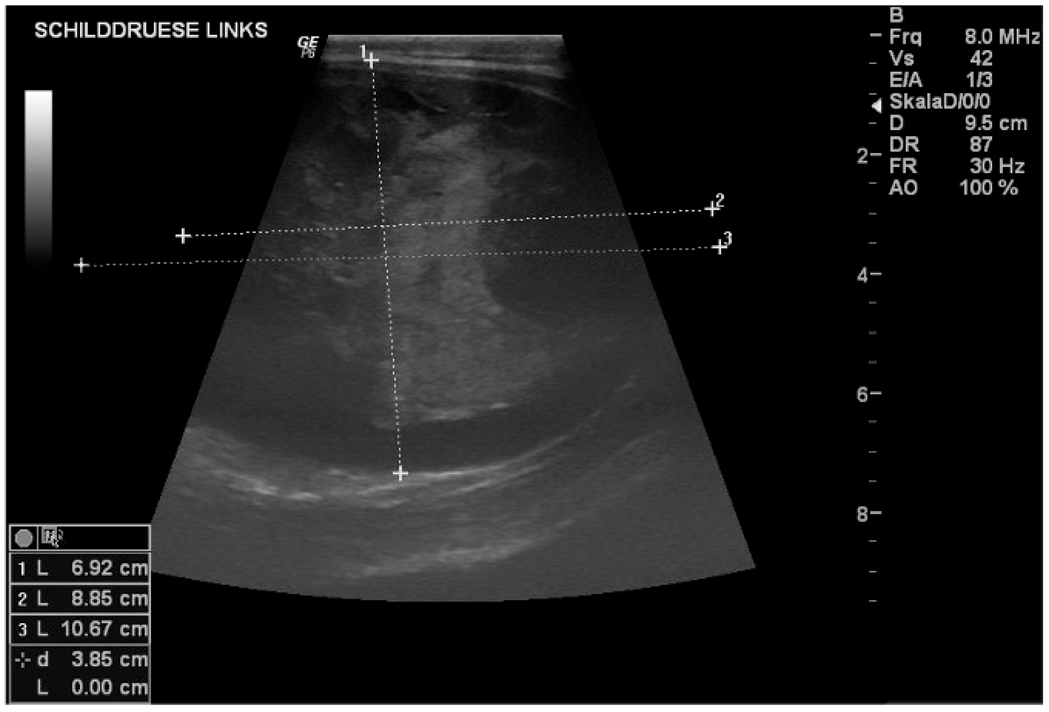 Thyroid Disease in Horses—Retrospective Case Series on Patients ...