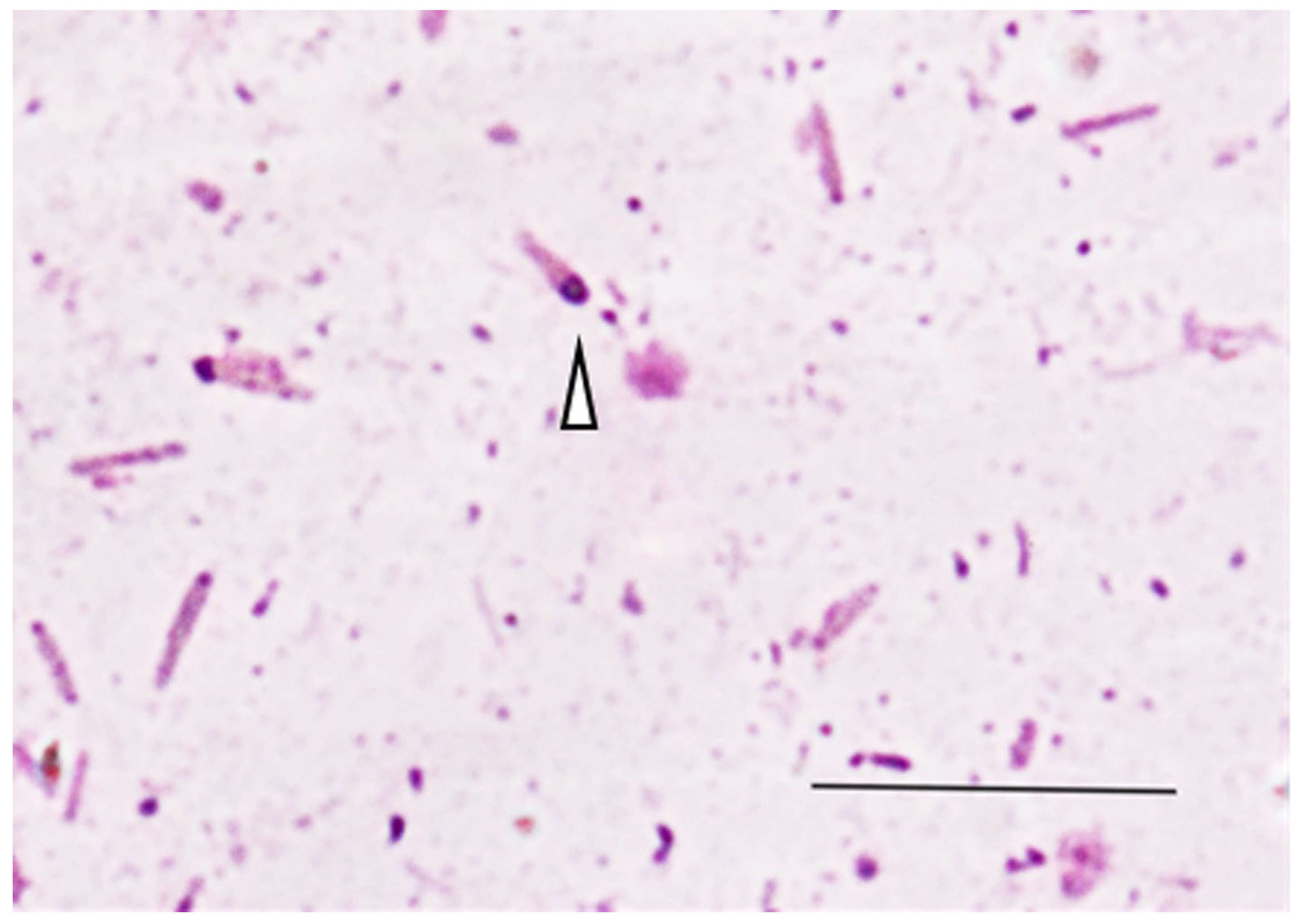 Severe Generalized Tetanus in a Chimpanzee (Pan troglodytes) Under ...