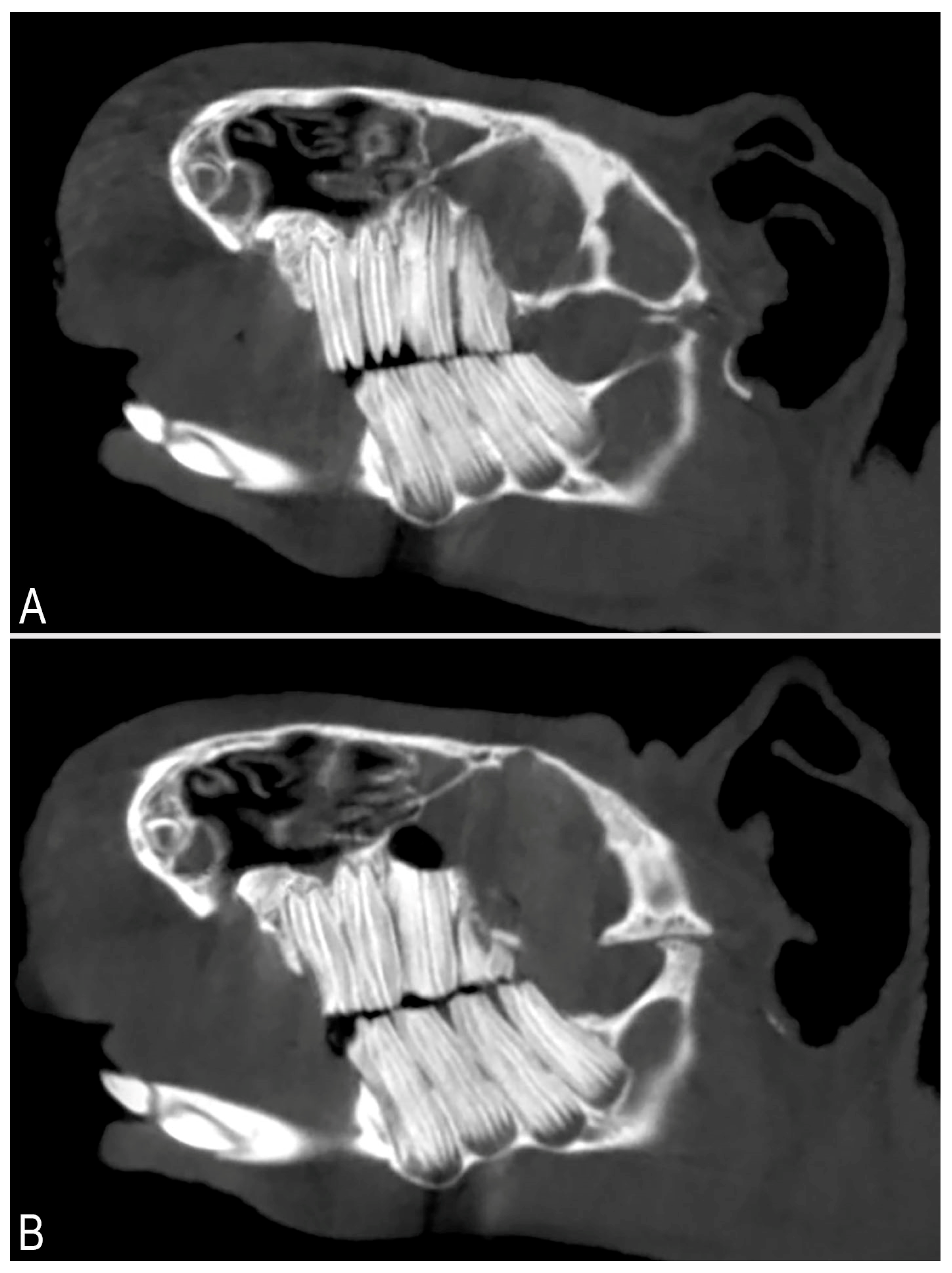 Ventral Transorbital Apicoectomy of the Maxillary Second and Third ...