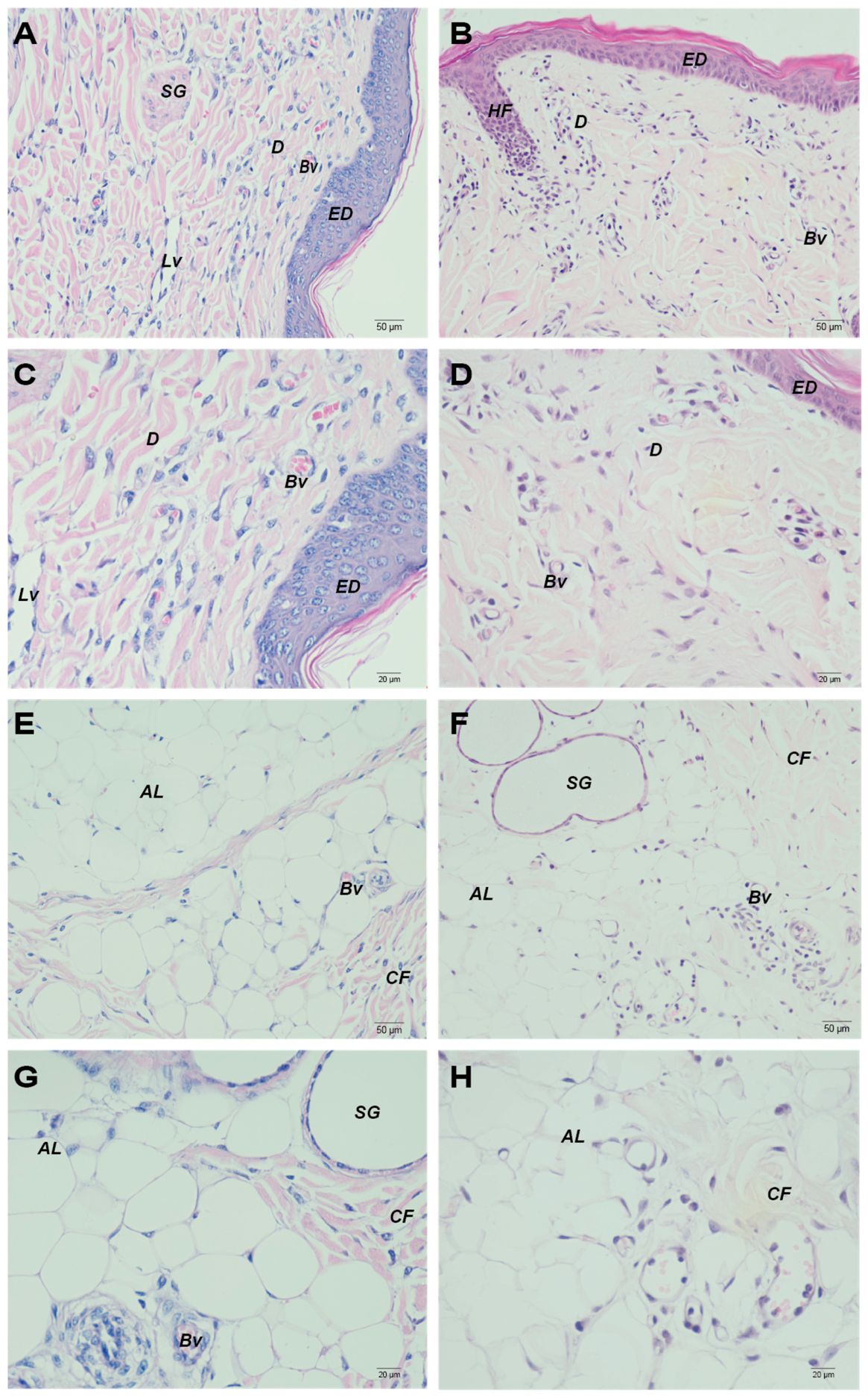 Cytological Evidence of Telocyte Involvement in Skin Immune Regulation ...