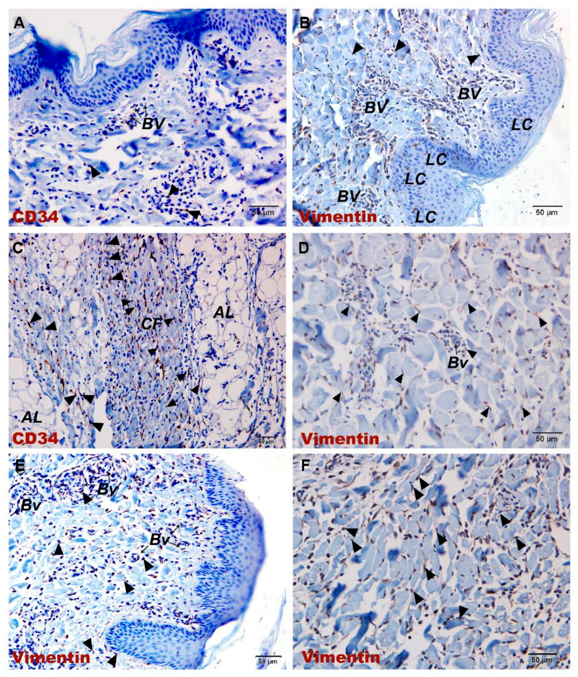 Cytological Evidence of Telocyte Involvement in Skin Immune Regulation ...