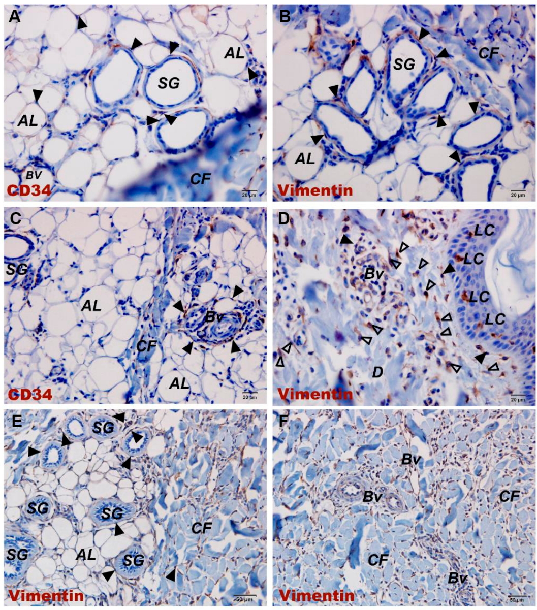 Cytological Evidence of Telocyte Involvement in Skin Immune Regulation ...