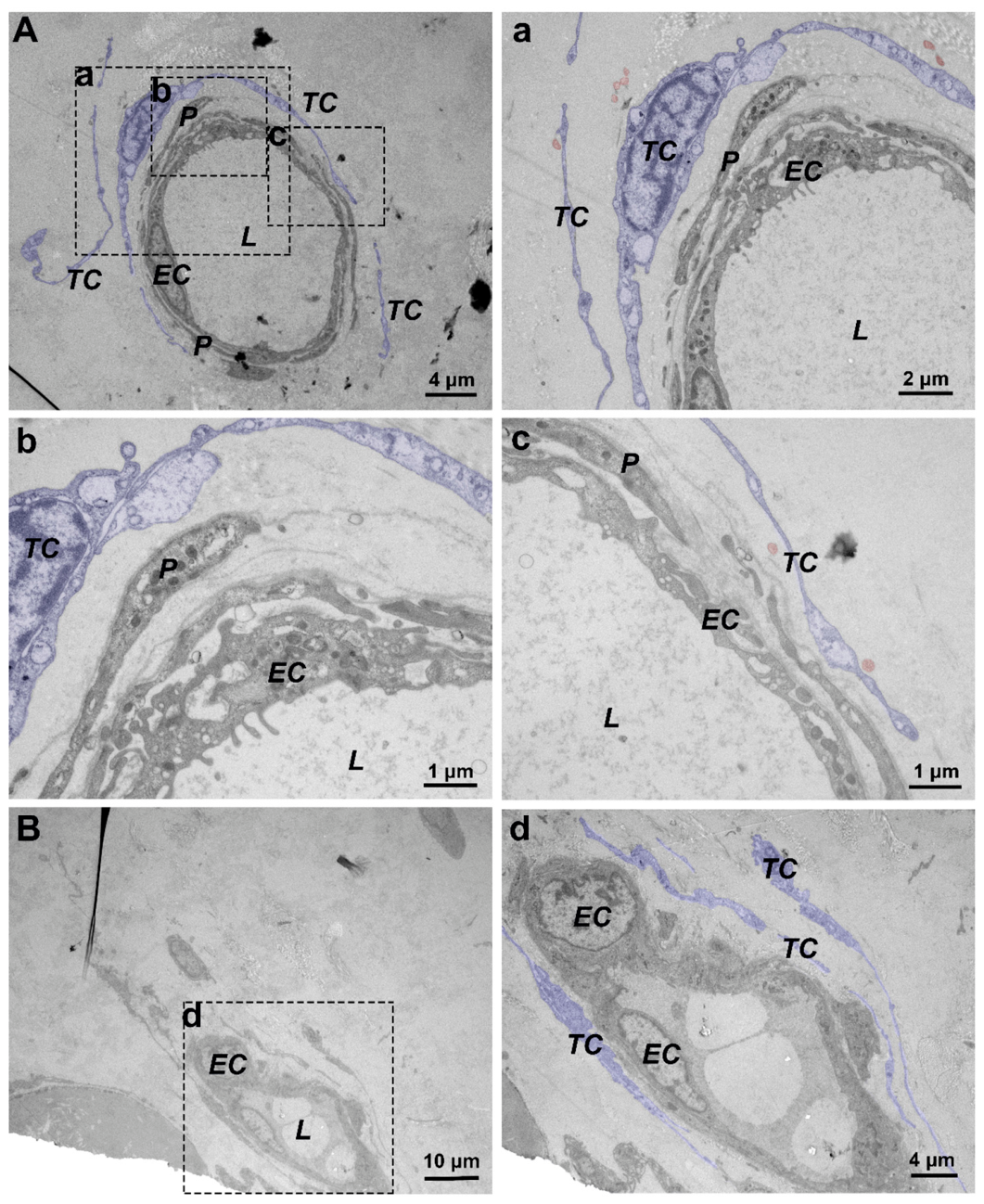 Cytological Evidence of Telocyte Involvement in Skin Immune Regulation ...