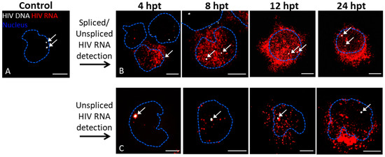 Visualization of HIV-1 RNA Transcription from Integrated HIV-1 DNA in ...