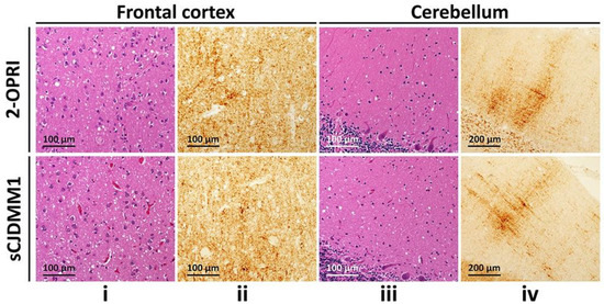 Characterization of Prion Disease Associated with a Two-Octapeptide ...